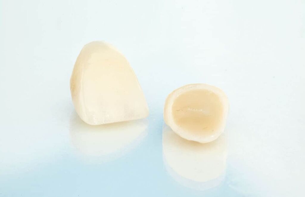 Porcelain Crowns - Dr. Sorin Boeriu & Associates - Kitchener Dental Office